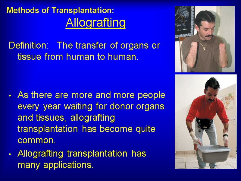 Transplantation Immunology Transplantation Immunology Outline ...