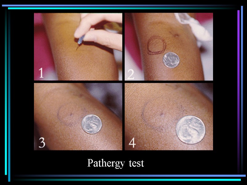 Oral Ulcerations Azmi Darwazeh BDS., MSc., PhD., FFD