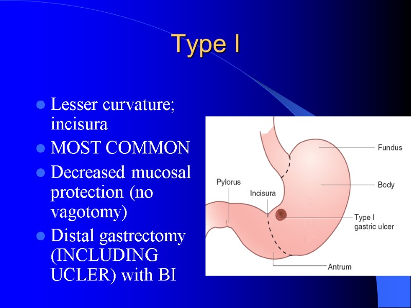 Gastric and duodenal ulcer disease Anatomy Arterial blood