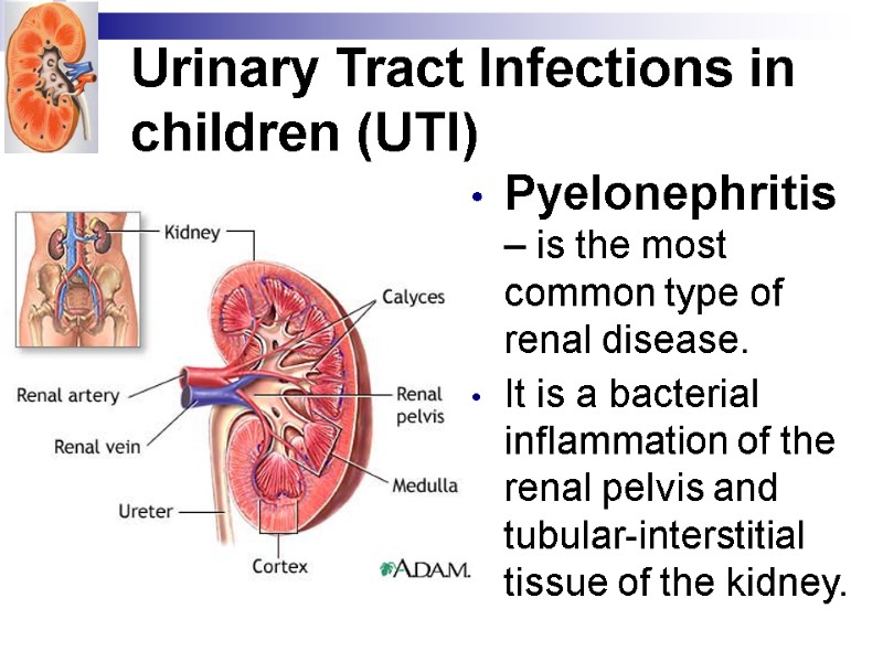 Urinary Tract Infections in children Rakovska L. Ass.