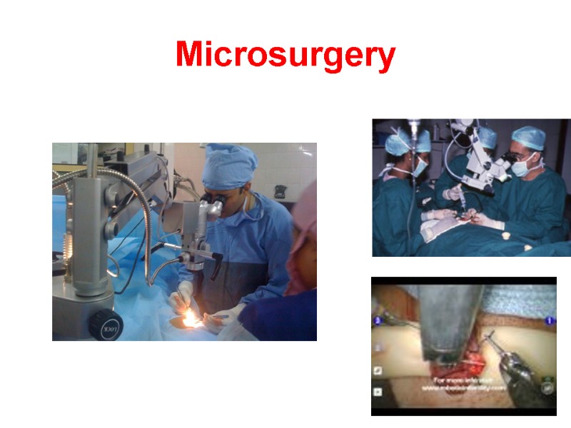 Varicocele Varicocele Definition Etiology Pathophysiology of testicular ...
