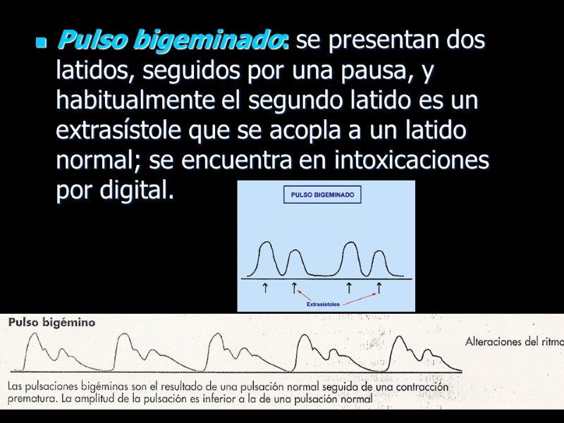 Sistema Vascular Periférico Por: CAROLINA MORA NAVARRO CHRISTIAN