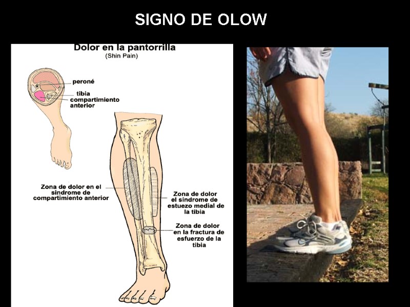 Sistema Vascular Periférico Por: CAROLINA MORA NAVARRO CHRISTIAN