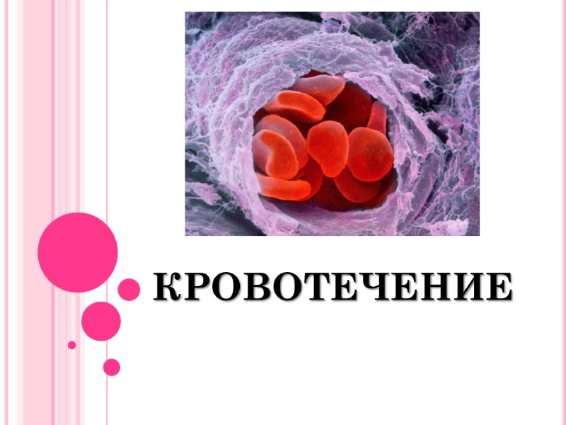 Кровотечение Кровотечение Кровотечение (haemorragia, haemo- кровь ...