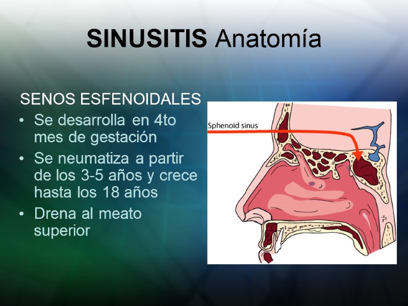 SINUSITIS Dra. Sandra Castaño Pediatra Neumóloga Dr. Felipe