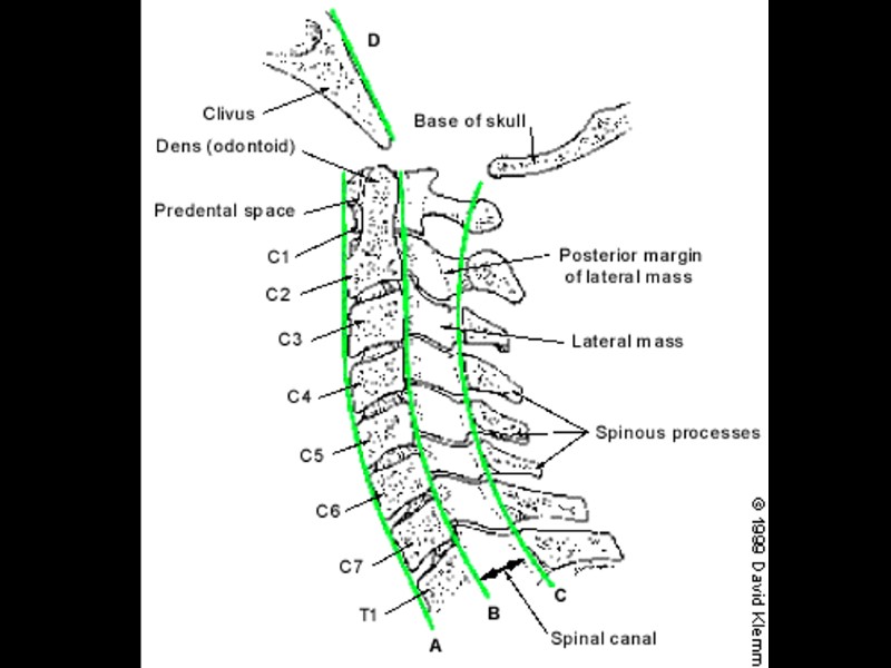 Anatomy Lecture 5 Trunk & Spine Physician Assistant