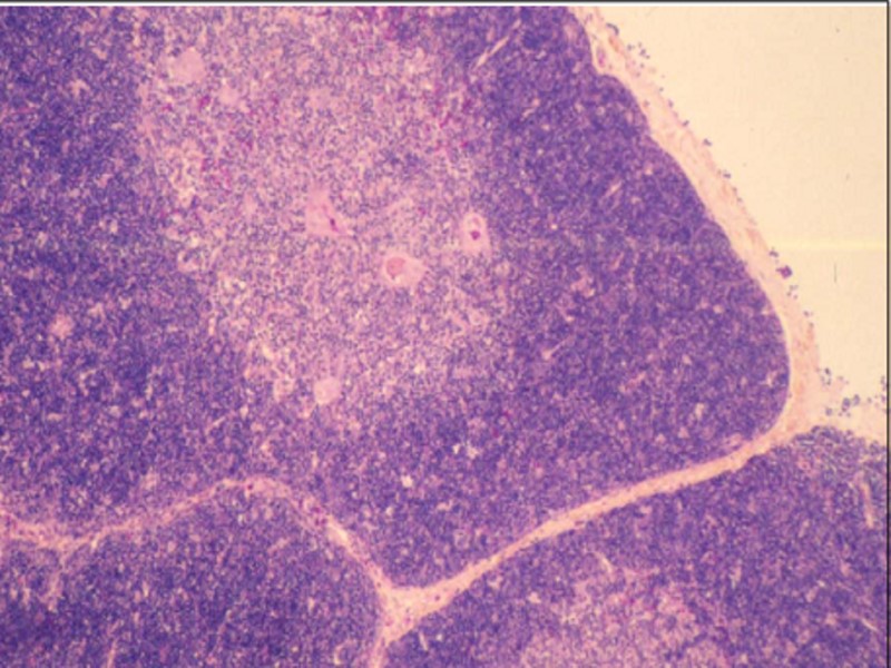 IMMUNE SYSTEM The major organs of the immune