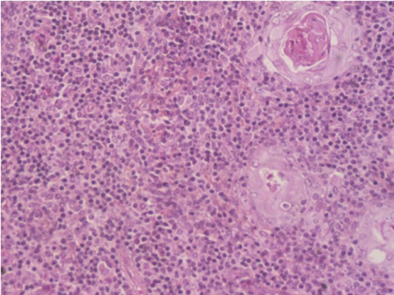 IMMUNE SYSTEM The major organs of the immune