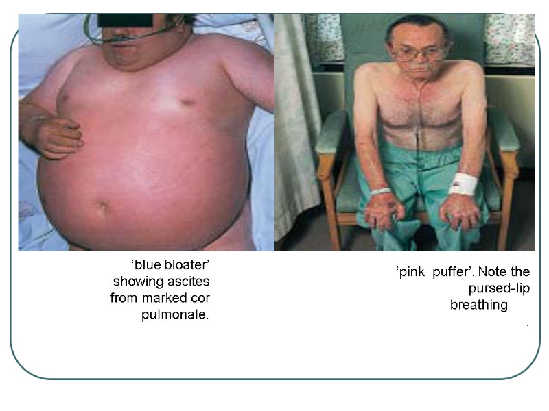 Assessment of respiratory system Dr .Essmat Gemaey Assistant