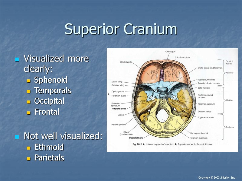 Cranium RTEC 233 Fall 2008 Week 1