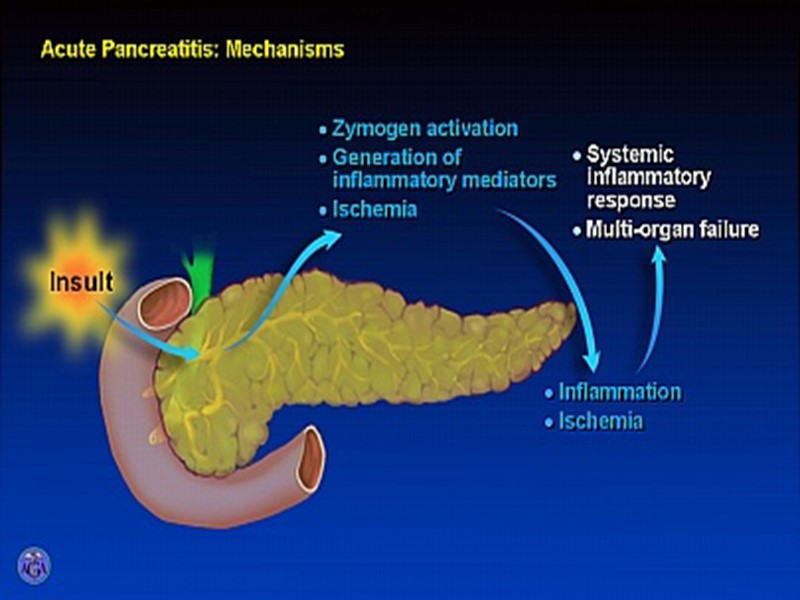 Acute Pancreatitis Dr. Eddie Koifman Gastroenterology Dpt. RAMBAM