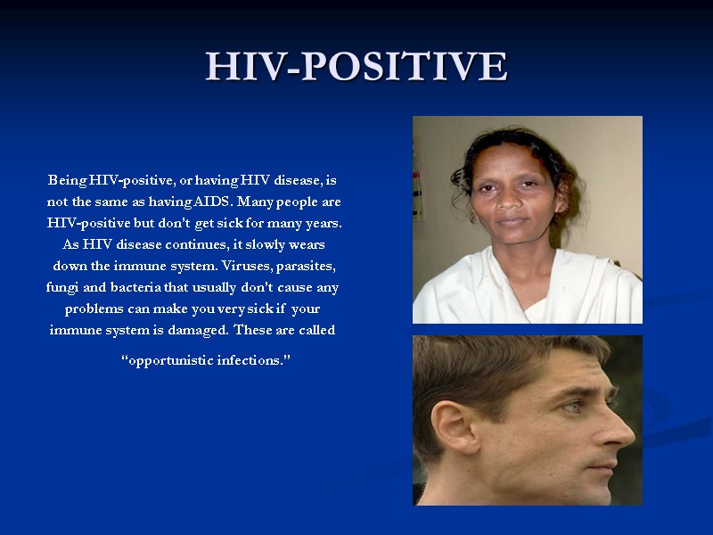 WHAT DOES “AIDS” MEAN? AIDS stands for Acquired