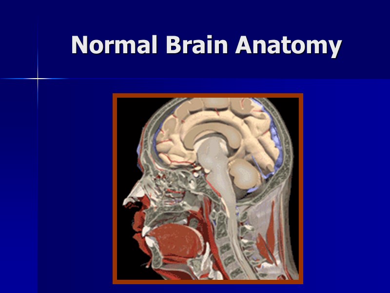 Brain Death Anatomy and Physiology Joel S. Cohen,