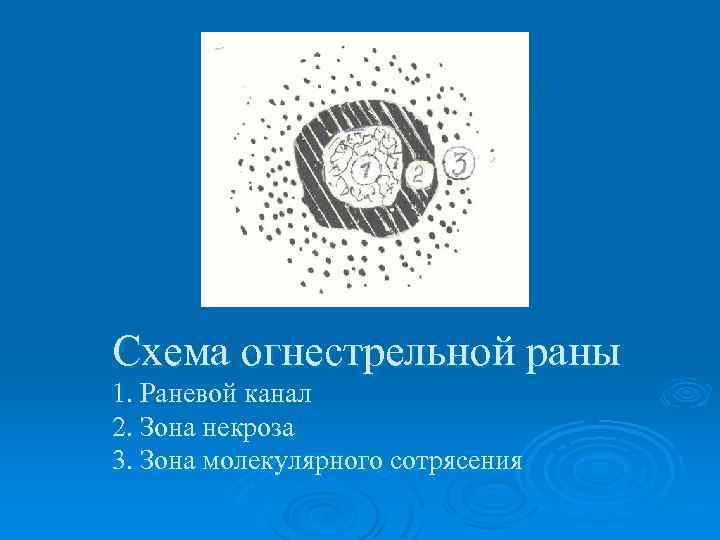 РАНЫ Классификация ран vulnus 1 2 Ø