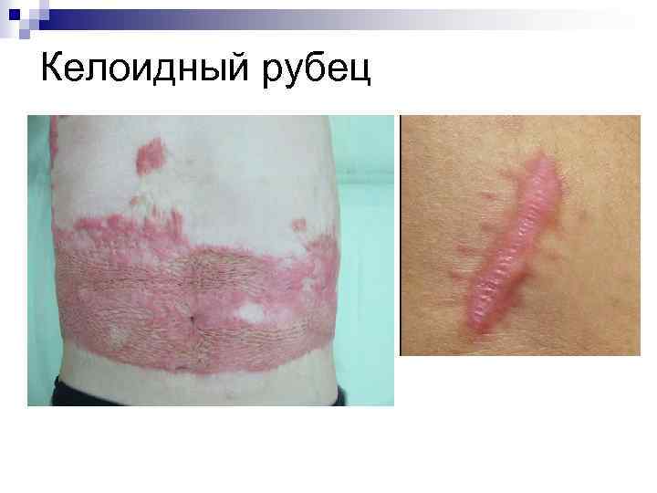 Раны Рана vulnus Всякое механическое повреждение организма