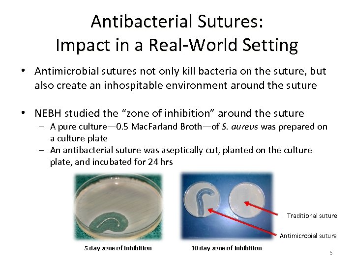 SSI risk can be addressed by controlling risk