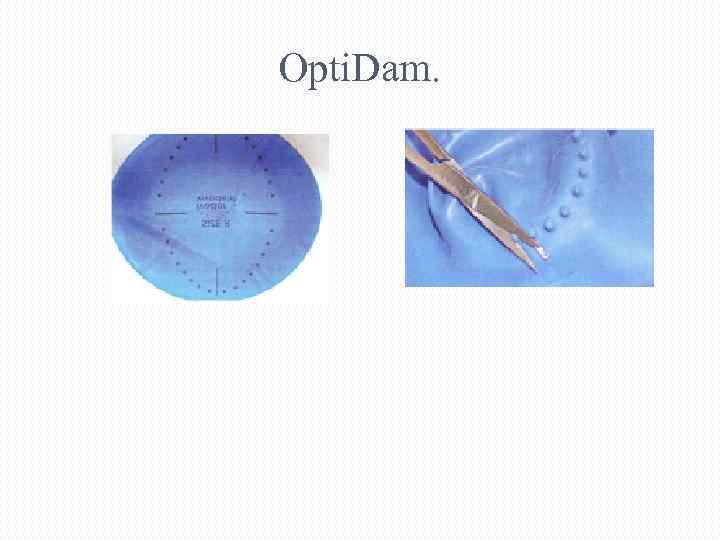 Методы изоляции и защиты рабочего поля Коффердам минидам