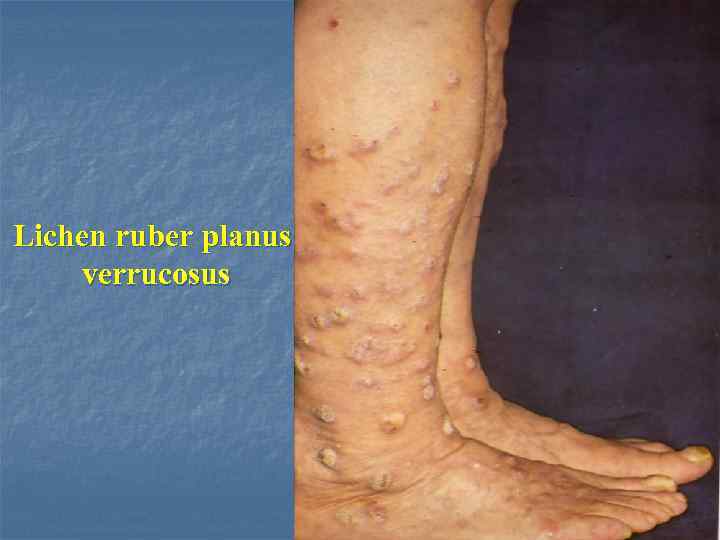 ЗАБОЛЕВАНИЯ С НЕВЫЯСНЕННОЙ ЭТИОЛОГИЕЙ ПРОФ СОЛОШЕНКО Э Н