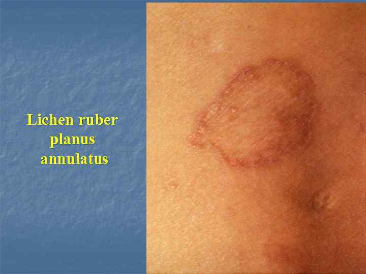 ЗАБОЛЕВАНИЯ С НЕВЫЯСНЕННОЙ ЭТИОЛОГИЕЙ ПРОФ СОЛОШЕНКО Э Н