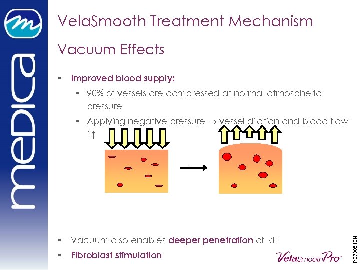 VELASMOOTH PRO CLINICAL PRESENTATION January 2010 PB 73051