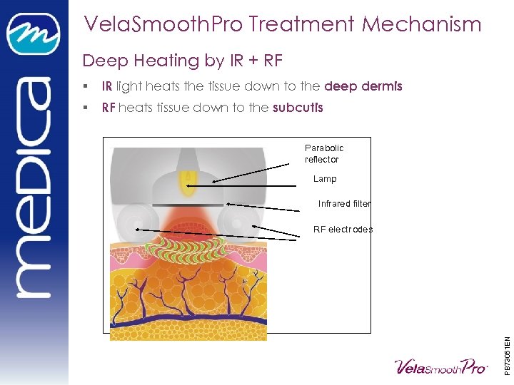 VELASMOOTH PRO CLINICAL PRESENTATION January 2010 PB 73051