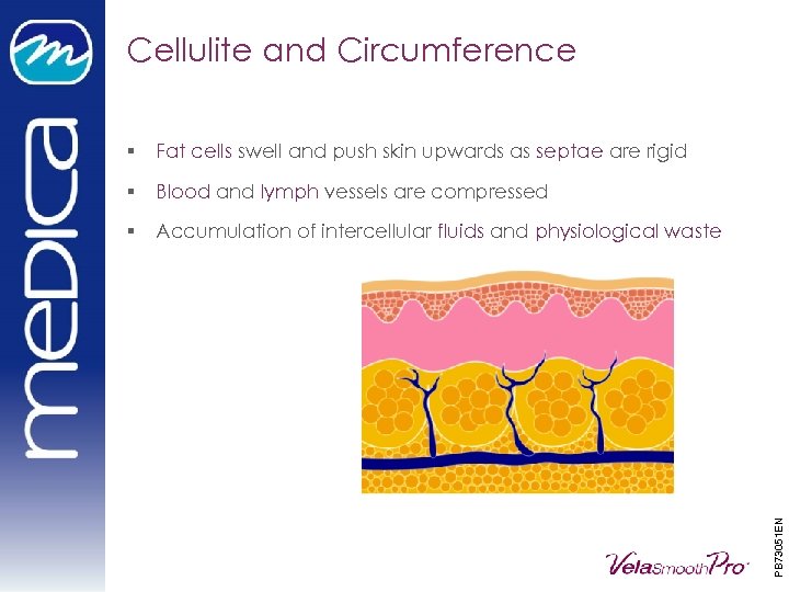 VELASMOOTH PRO CLINICAL PRESENTATION January 2010 PB 73051