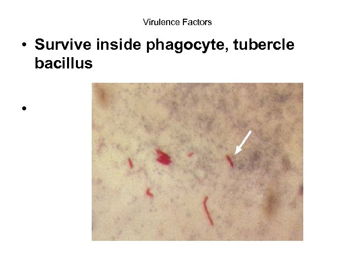 Microbiology Chapter 13 Pathology Science of study