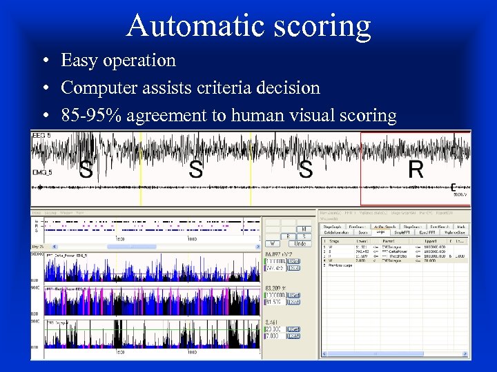 Sleep Analysis Software Sleep Sign for Animal