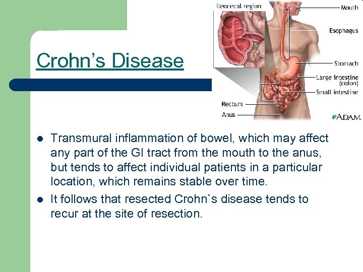 Inflammatory Bowel Disease Dr WM Simmonds Internal Medicine