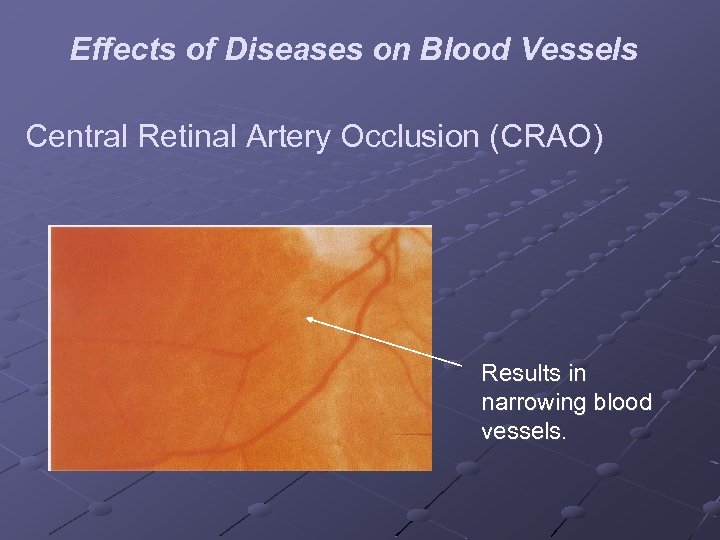 Automatic Detection of Blood Vessels in Digital Retinal