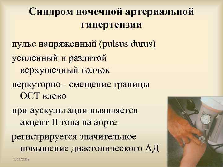 Болезни почек Вопросы лекции Синдромы