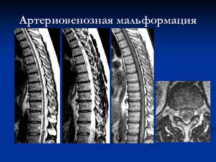 Лучевая диагностика заболеваний спинного мозга Кафедра лучевой диагностики