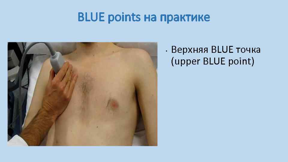 Ультразвуковое исследование легких и плевры Преимущества УЗИ