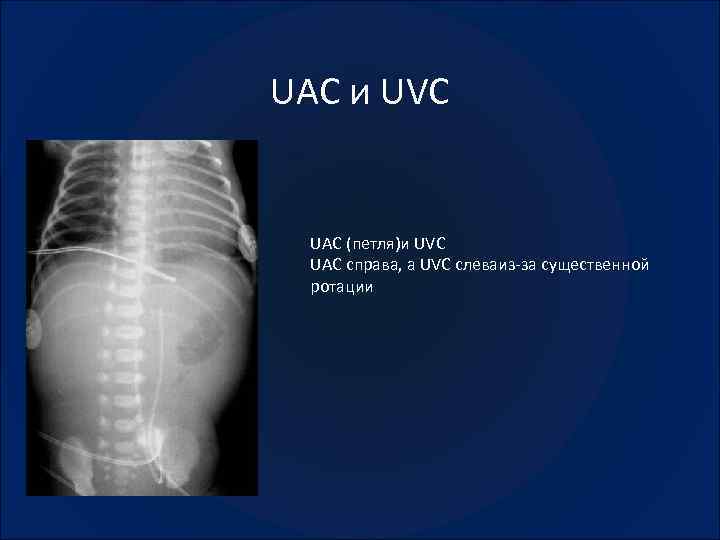 КЛИНИЧЕСКАЯ ОЦЕНКА РЕНТГЕНОГРАММИванов С Л Детская городская больница