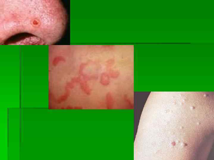 Морфологические и функциональные особенности кожи и ее производных