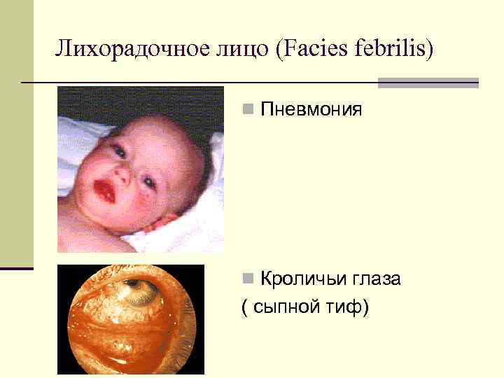 status praesens ВНЕШНИЙ ОСМОТР БОЛЬНОГО INSPECTIO Занятие 2