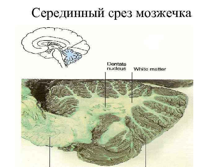 Структурно-функциональный обзор головного мозга Головной мозг (Encephalon)