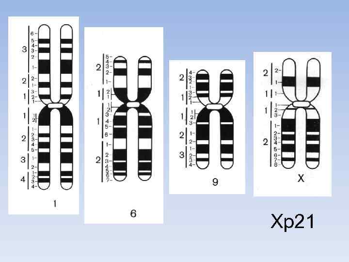 Основы клинической цитогенетики Xp 21