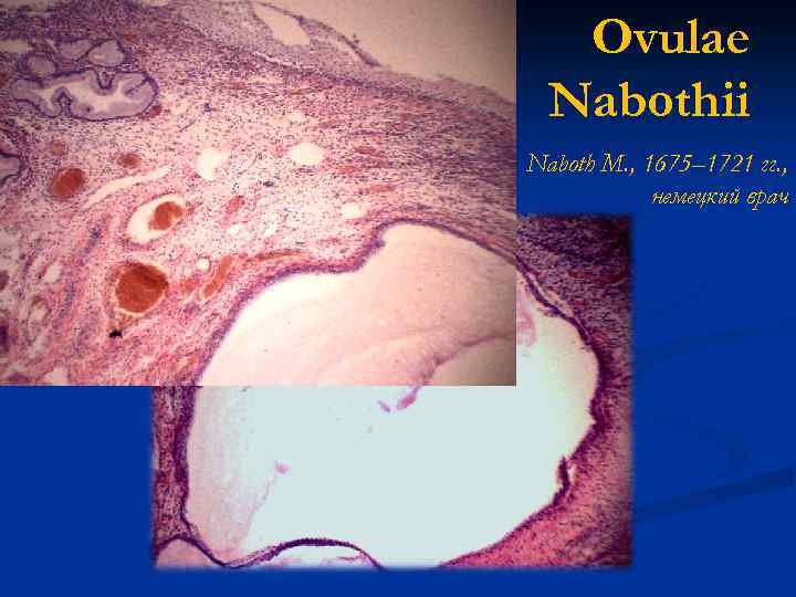 Гинекологическая патология Бактериальный вагиноз Дрожжевой кольпит