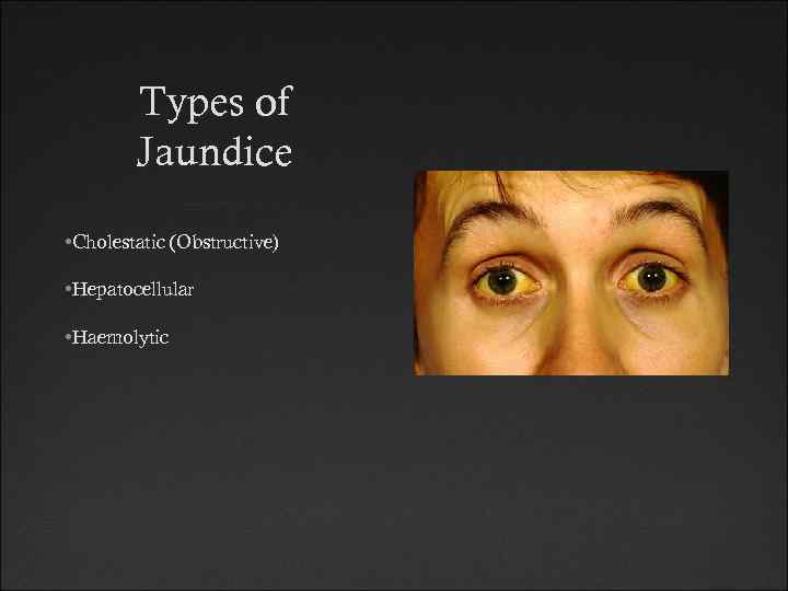JAUNDICE BY MARJAN GHADIRI 14 8 2010 Definition of