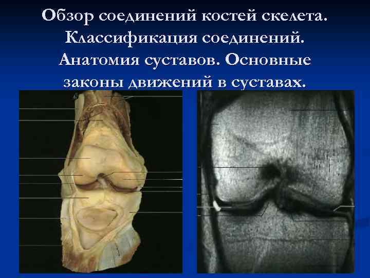 Обзор соединений костей скелета Классификация соединений Анатомия суставов