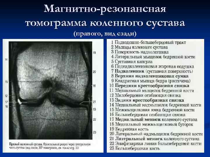 Обзор соединений костей скелета Классификация соединений Анатомия суставов