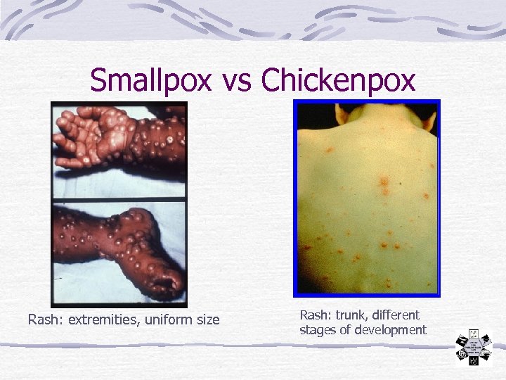 UCLA Center for Public Health and Disasters Bioterrorism