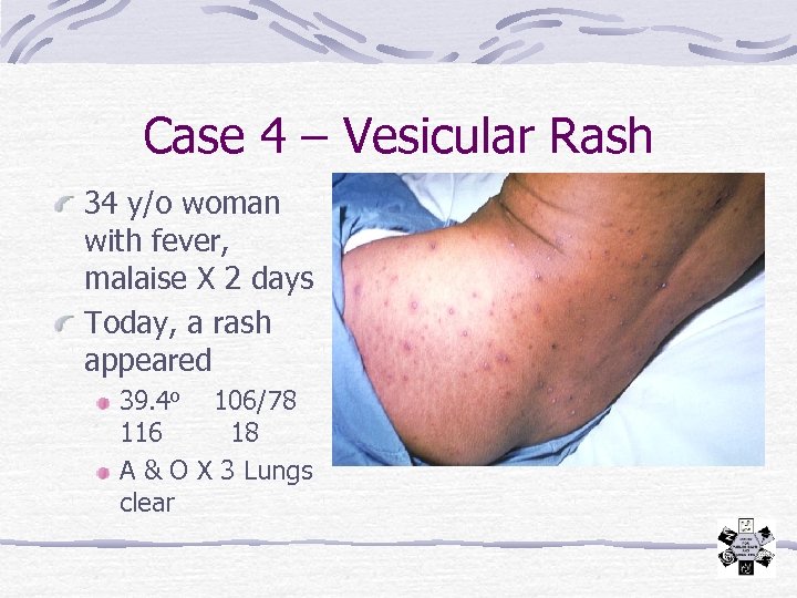 UCLA Center for Public Health and Disasters Bioterrorism