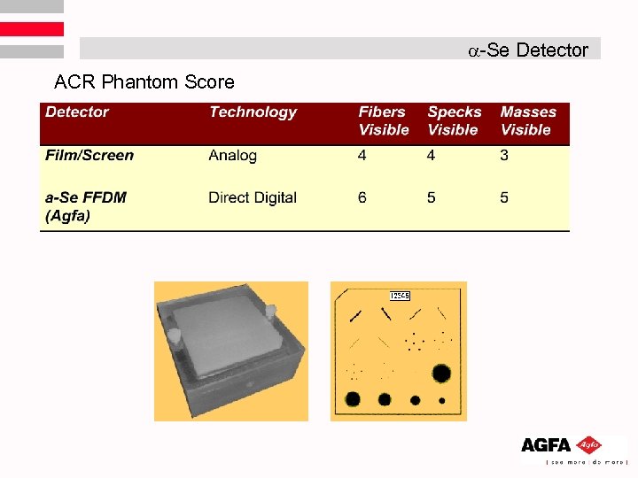 Agfa DR Mammo Agfa Direct Digital Mammography DR