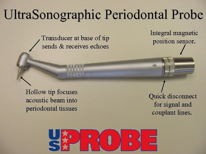 Ultra Sonographic Perio Probe A painless way to