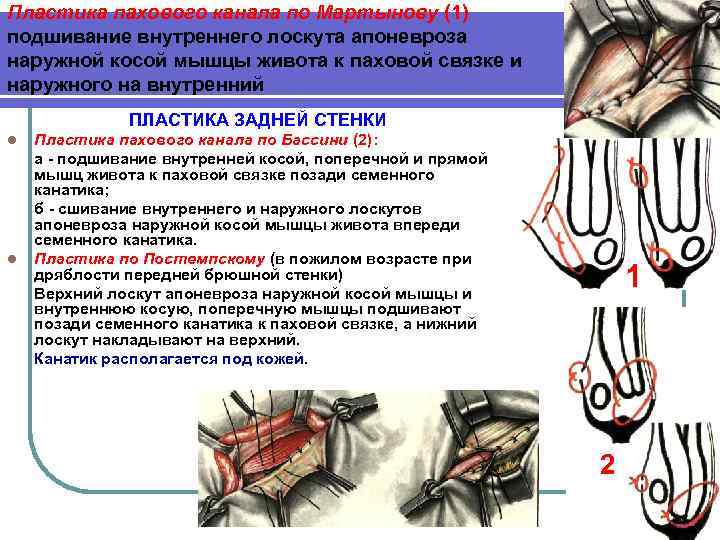 ЛЕКЦИЯ 4 ТОПОГРАФИЧЕСКАЯ АНАТОМИЯ ПЕРЕДНЕЙ БРЮШНОЙ СТЕНКИ