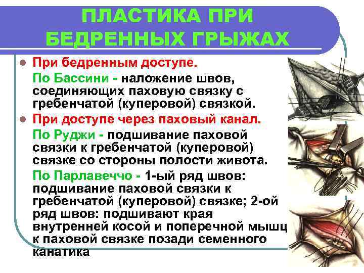 ЛЕКЦИЯ 4 ТОПОГРАФИЧЕСКАЯ АНАТОМИЯ ПЕРЕДНЕЙ БРЮШНОЙ СТЕНКИ