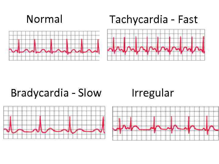 Electrical Processes Of The Heart CIE Biology Jones Electrical Processes Of The Heart CIE Biology Jones