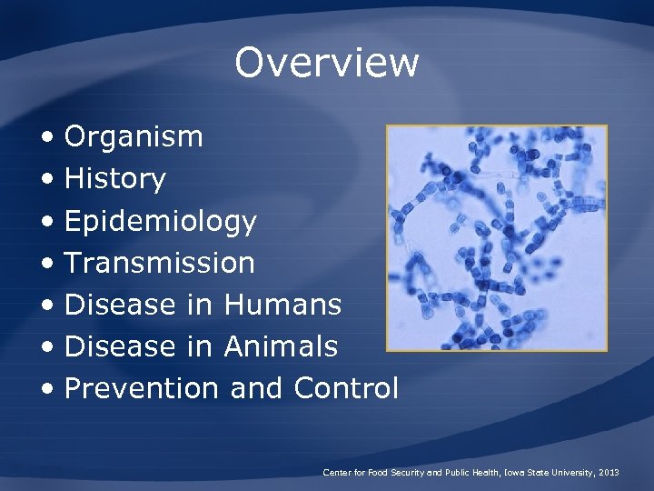 Coccidioidomycosis Valley Fever San Joaquin Valley Fever Desert